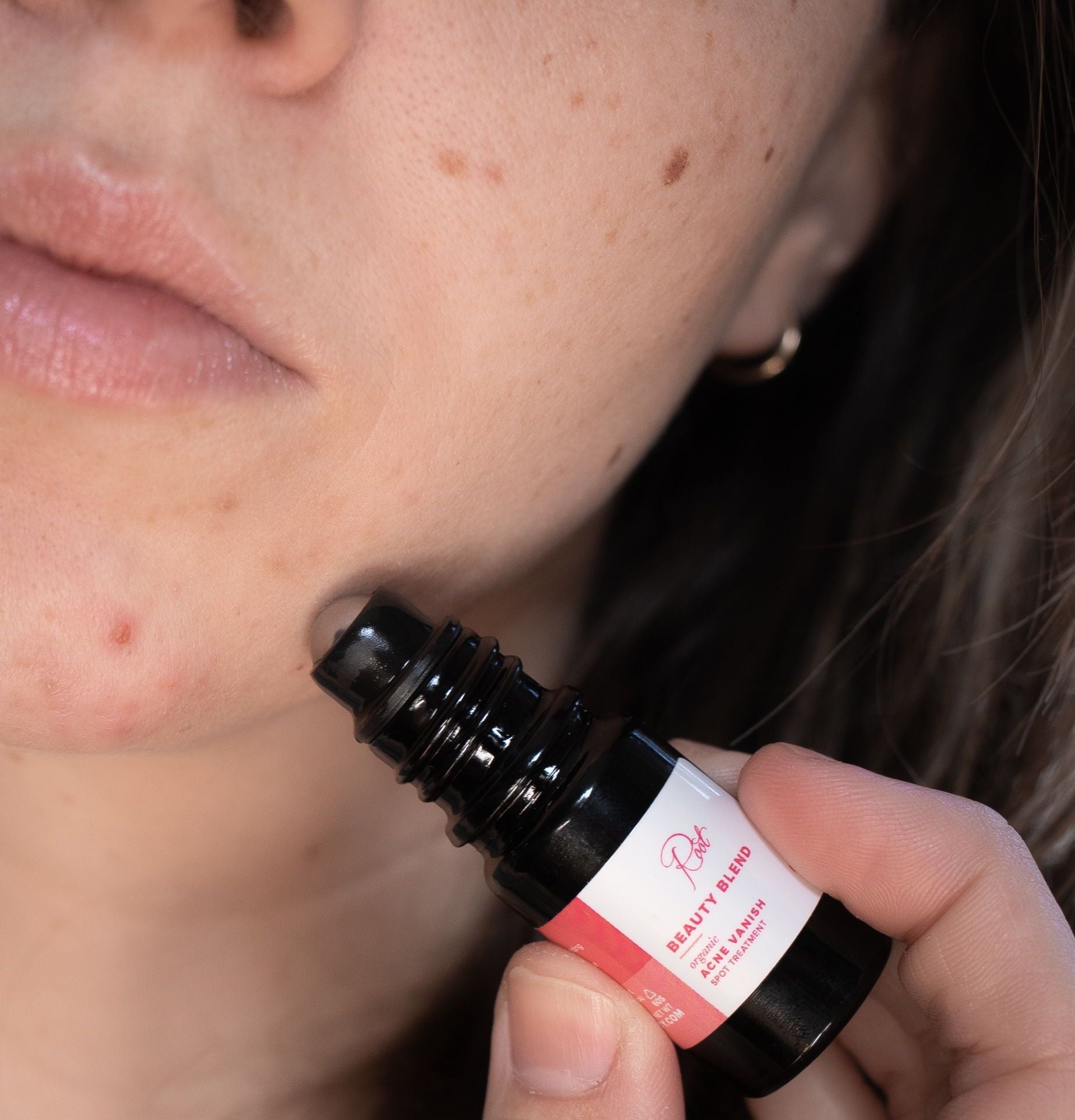 8 Reasons Why Your Face is Breaking Out – Root