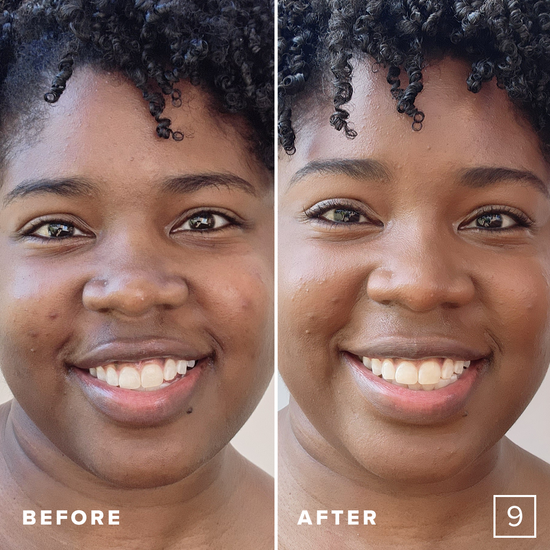 Pretty Skin Perfecter – Root